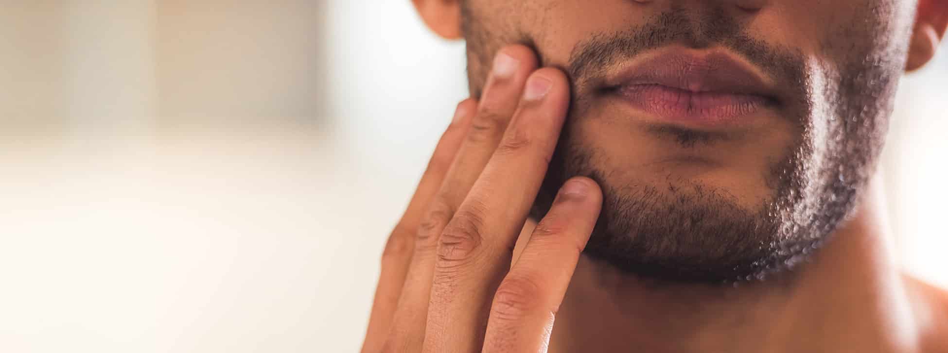 Skægtransplantation | Effektiv behandling | Start din skægvækst nu