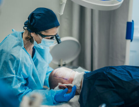 Hårtransplantation med FUE-teknikken | Få håret tilbage